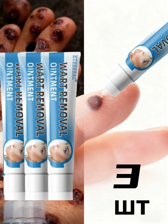 Крем средство для удаления бородавок, папиллом и родинок, безболезненно, не оставляет следов / 60г