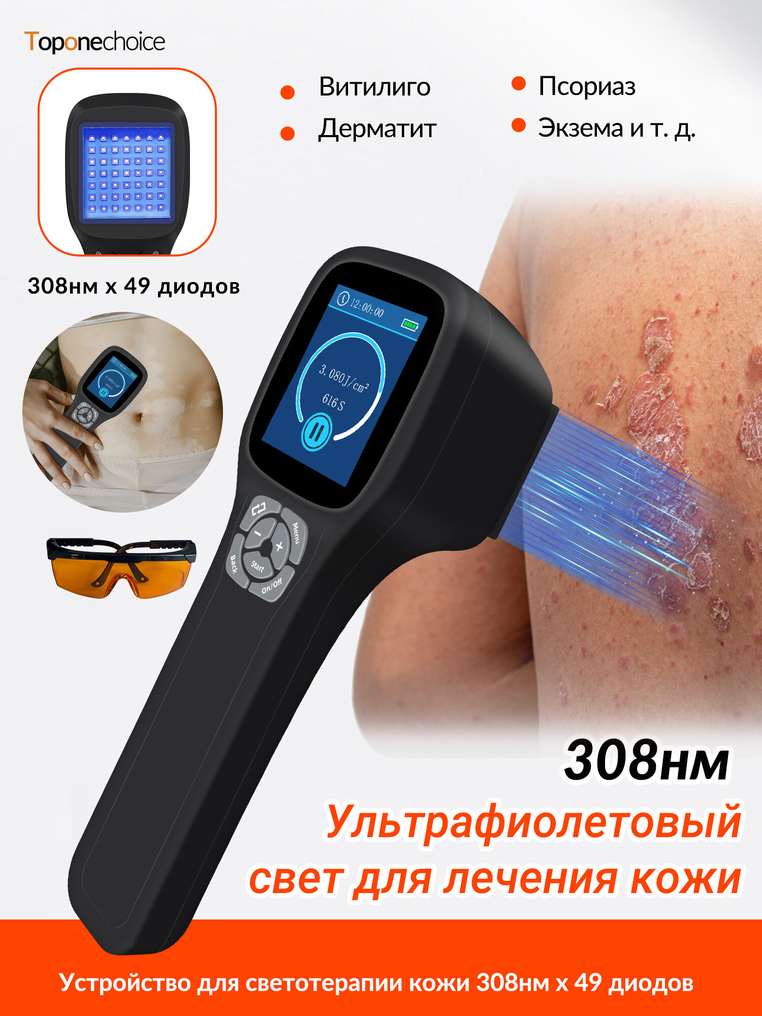 308нм узкополосный UVB прибор 49 диода для псориаза и витилиго, регулируемая доза, LCD дисплей, запись сеансов терапии