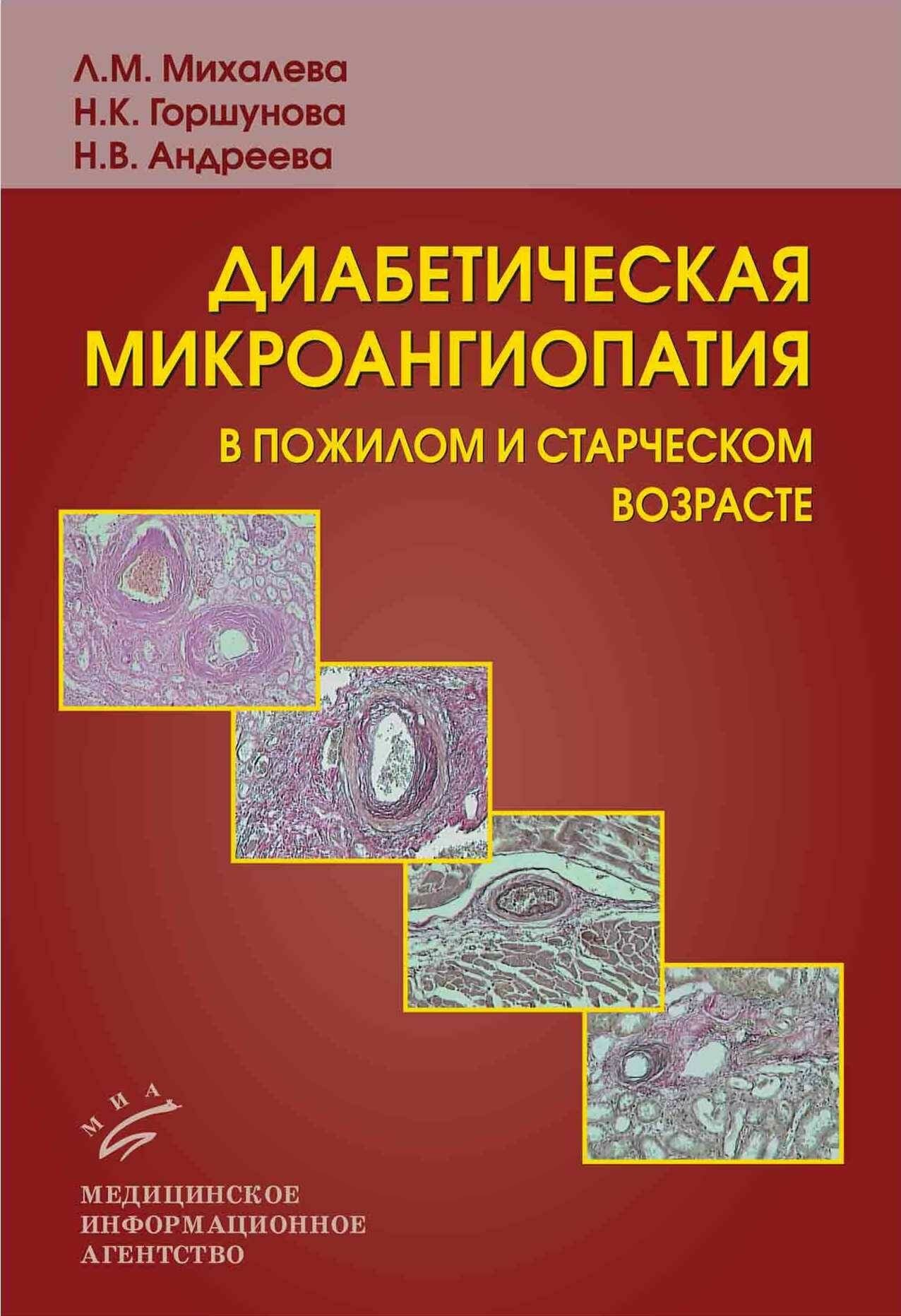 Диабетическая микроангиопатия в пожилом и старческом возрасте. Михалева