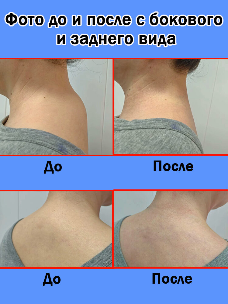 Пластырь