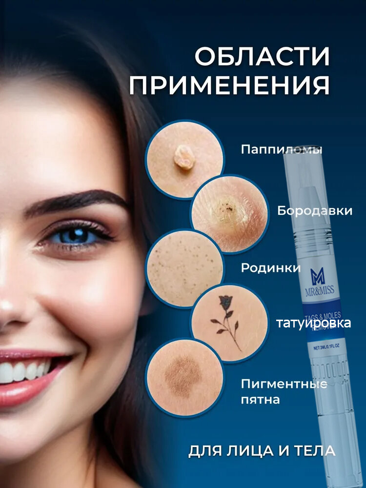 MR&MISS Эссенция для удаления бородавок, папиллом и родинок, безболезненно, без шрамов и побочных эффектов