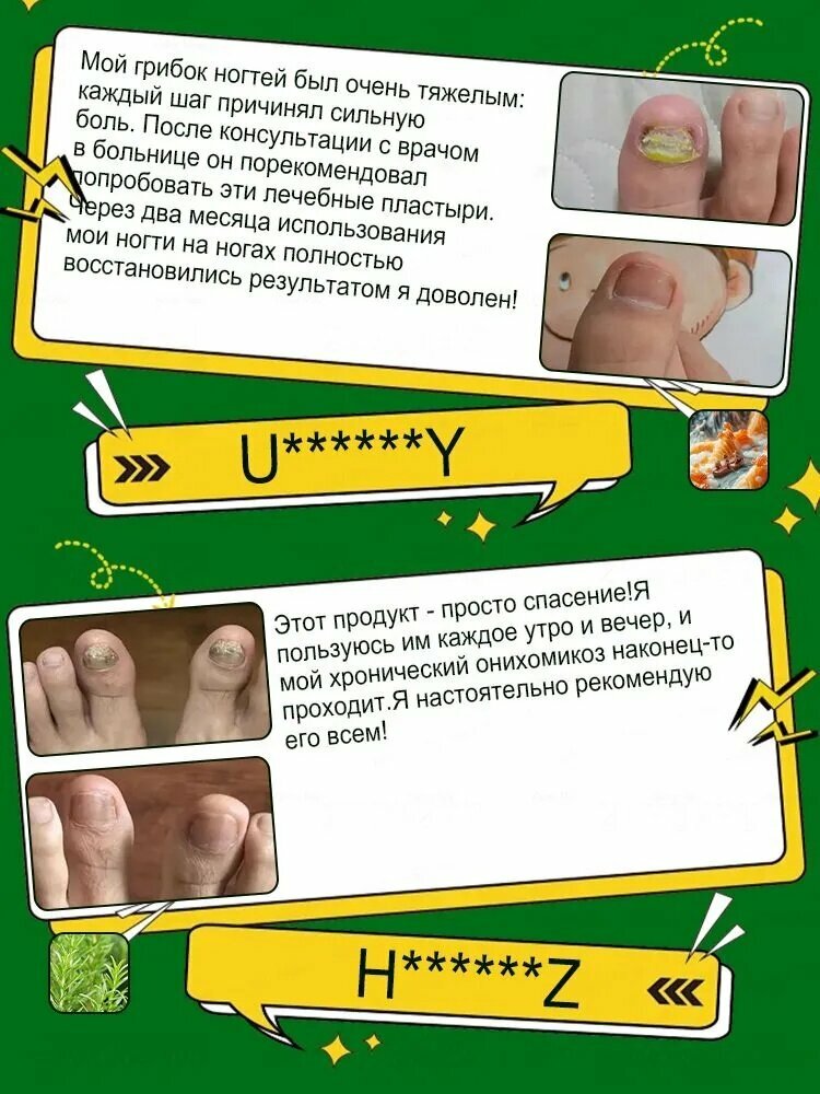 Пластыри от грибка ногтей быстро избавляют от грибковых инфекций рук и ног, а также вылечить утолщение ногтей, покраснение, отек, зуд, расслоение 63шт