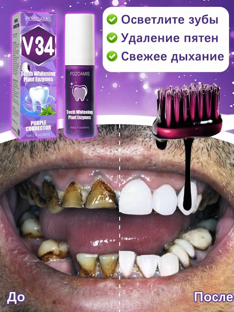 Отбеливание зубов, удаление зубного камня, налета и кариеса, поддержание гигиены полости рта и устранение неприятного запаха изо рта. Зубная паста для чувствительных зубов, не содержащая фтора/300 г