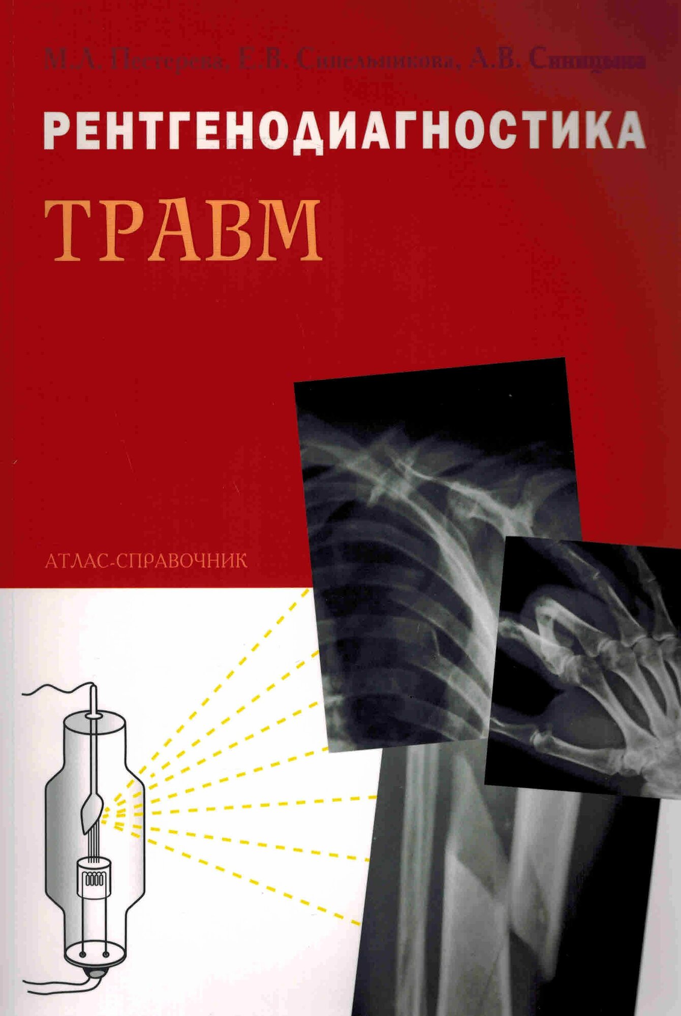 Рентгенодиагностика травм. Атлас - справочник
