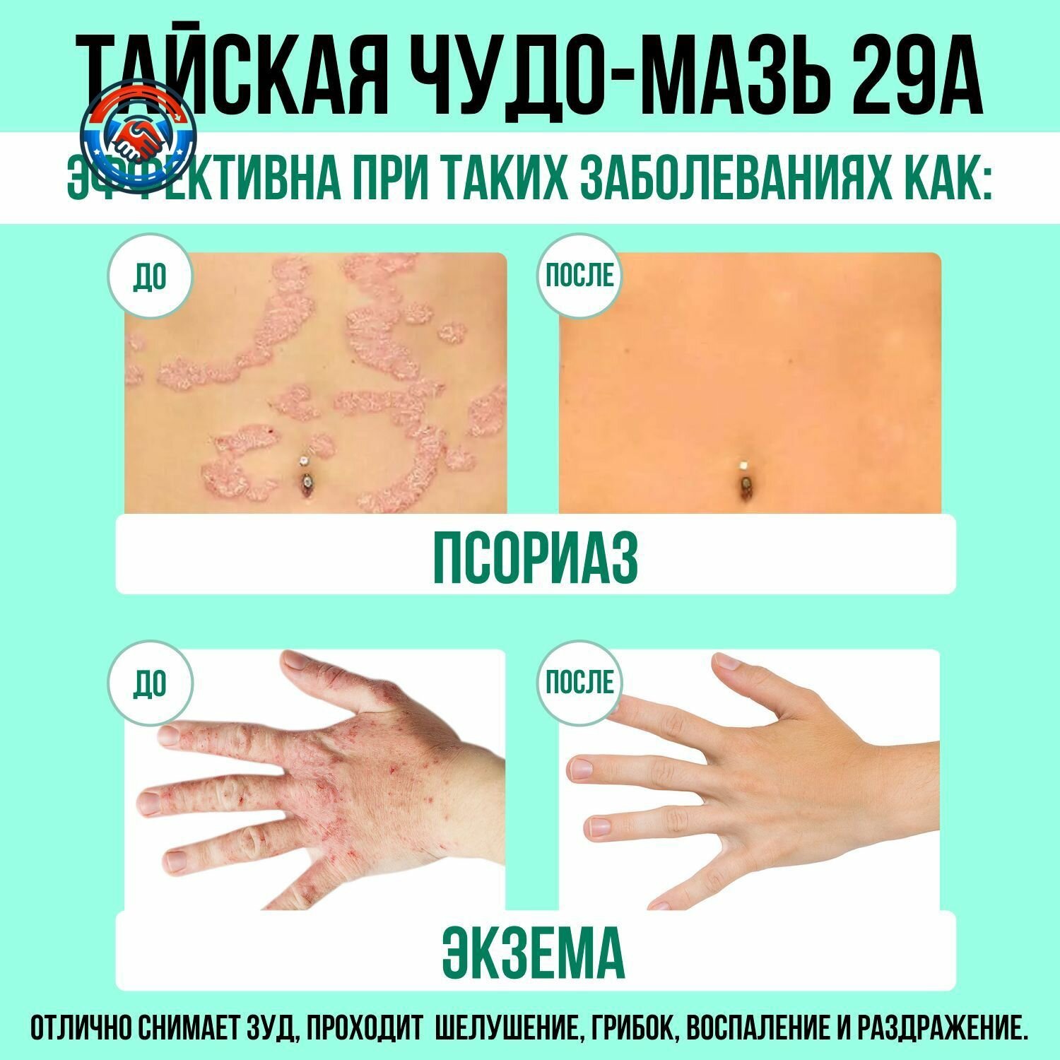 Тайская мазь 29А для лица и тела, универсальный бальзам от псориаза, экземы, акне, грибка и кожных раздражений, натуральный восстанавливающий крем для всей семени