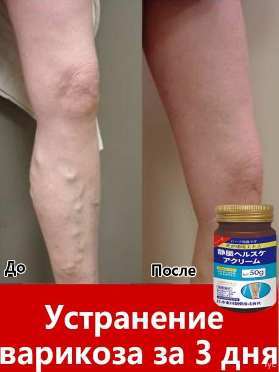 Эксклюзивный крем 50 г против варикоза, отеков, болевых ощущений и сосудистых звездочек