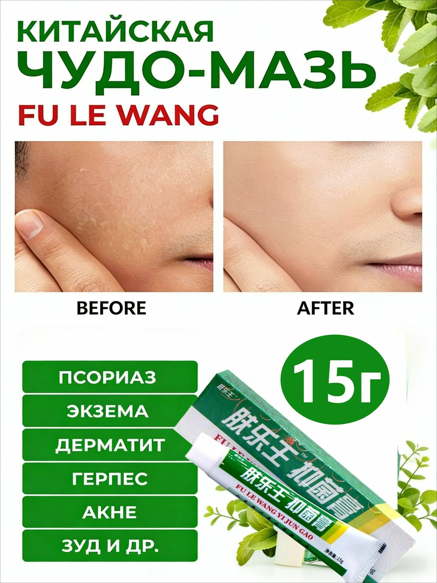 15 г Натуральный крем для ухода за кожей при экземе , Снимает кожный зуд, раздражение и шелушение