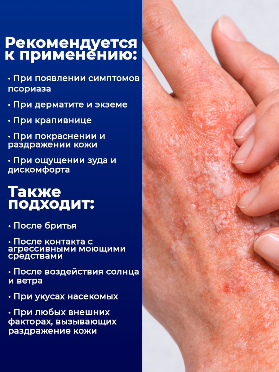 Лостеридерм: крем-мазь для ухода за кожей при псориазе, сухой и чувствительной коже, натуральный состав, 50 мл