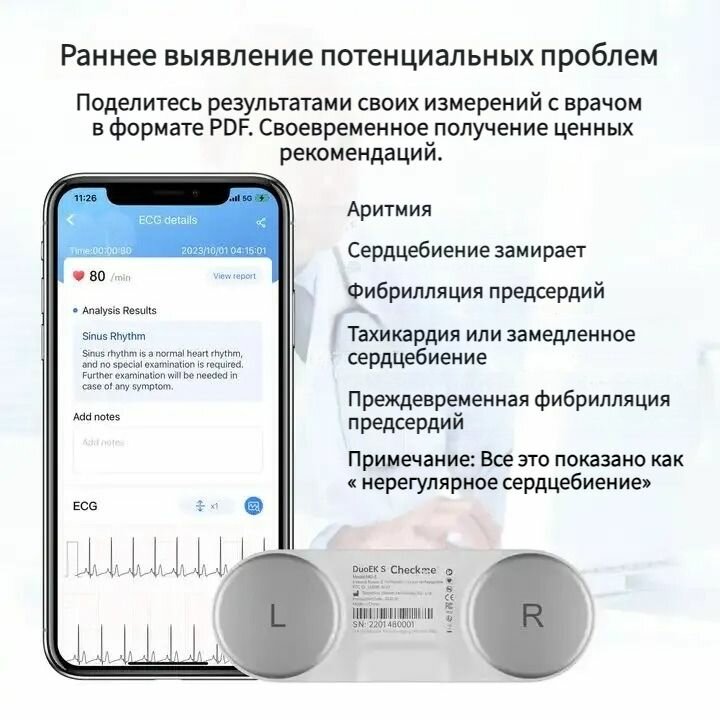 Кардиомонитор