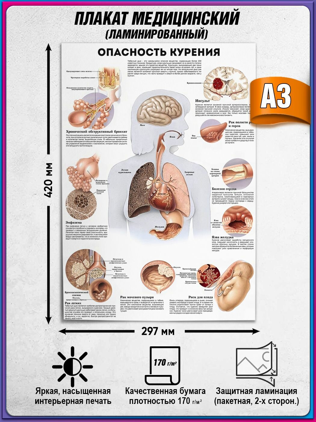 Информационный медицинский плакат "Опасность курения" / ламинированный / Формат А3 (30х42 см.)