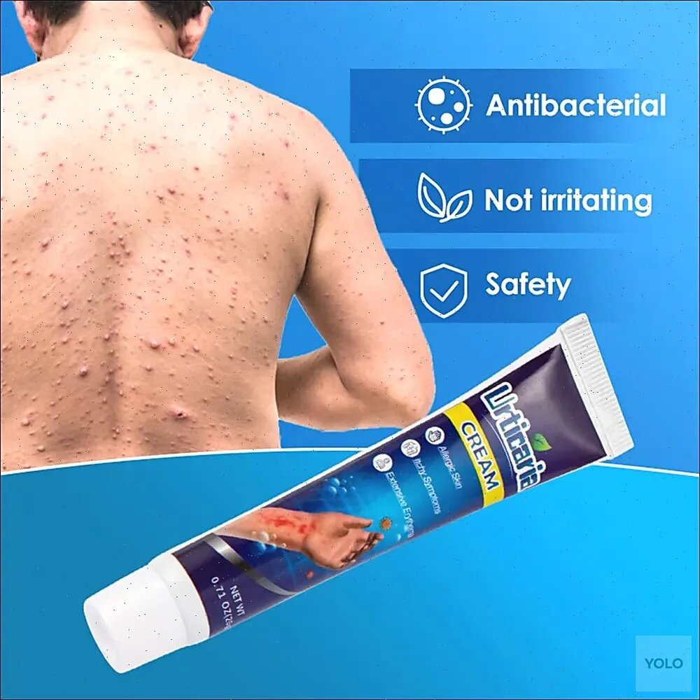 Urticaria Cream Крем для ухода за кожей от зуда и раздражения кожи, 20мл