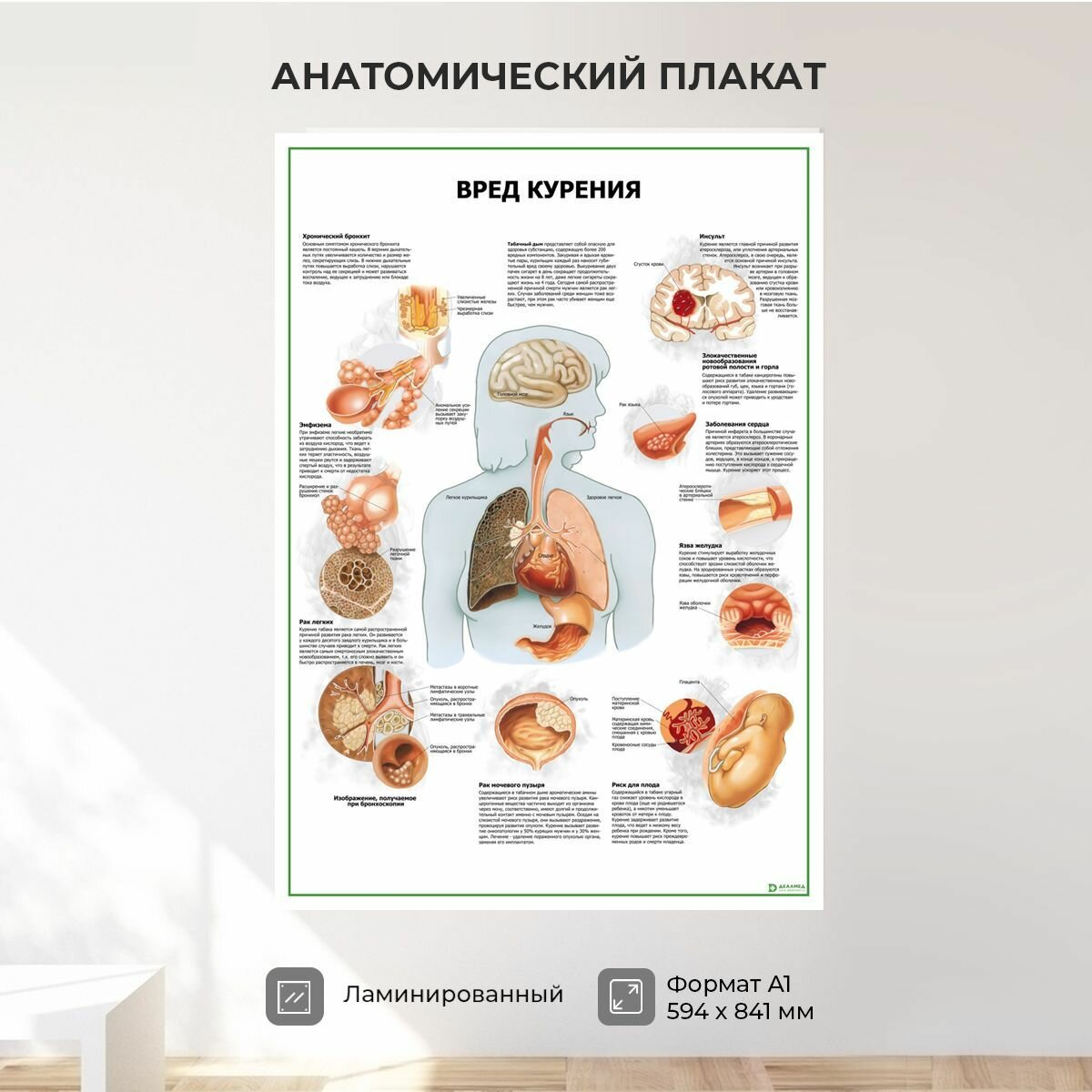 Обучающий медицинский плакат анатомия Вред курения А1