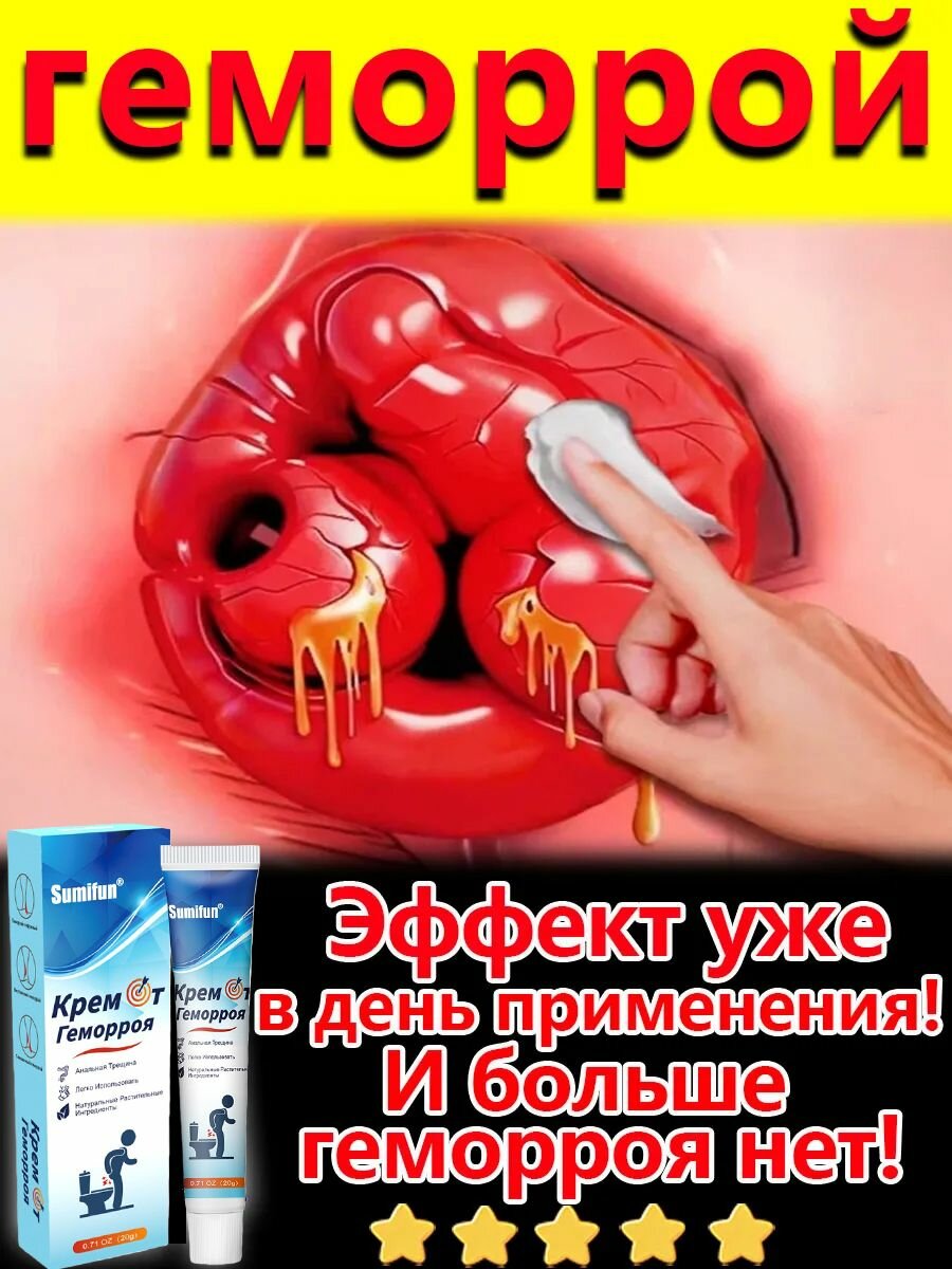 Мазь от геморроя китайское средство гербальный крем быстрое облегчение снятия зуда и отека без рецепта