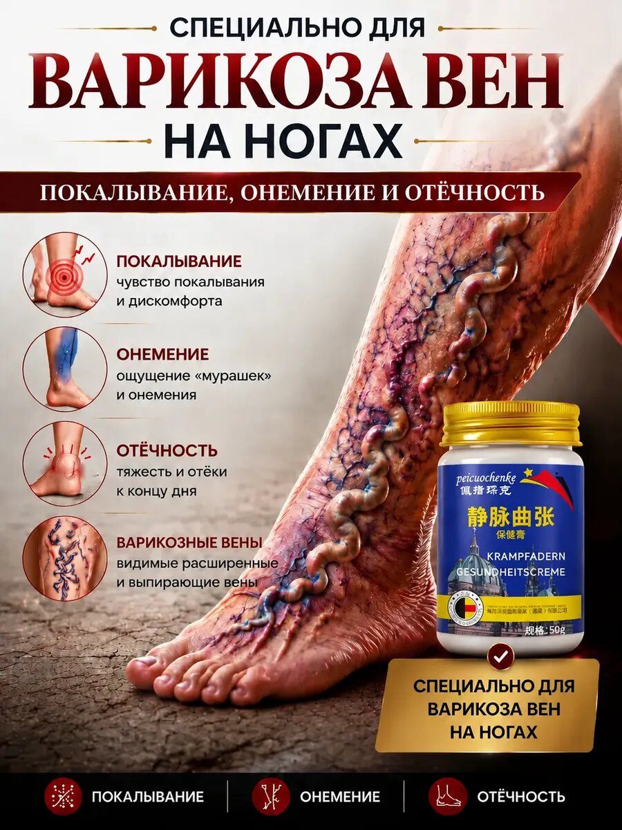 От варикоза вен на ногах