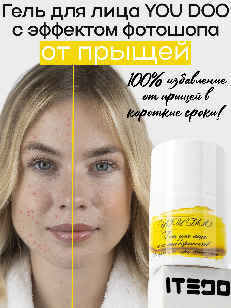 Гель для лица от несовершенств YOU DOO (от прыщей, закрытых комедонов, акне)