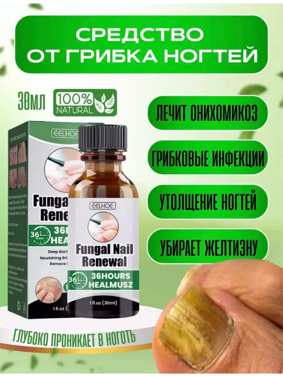 Китайское Средство от грибка ногтей 30 мл