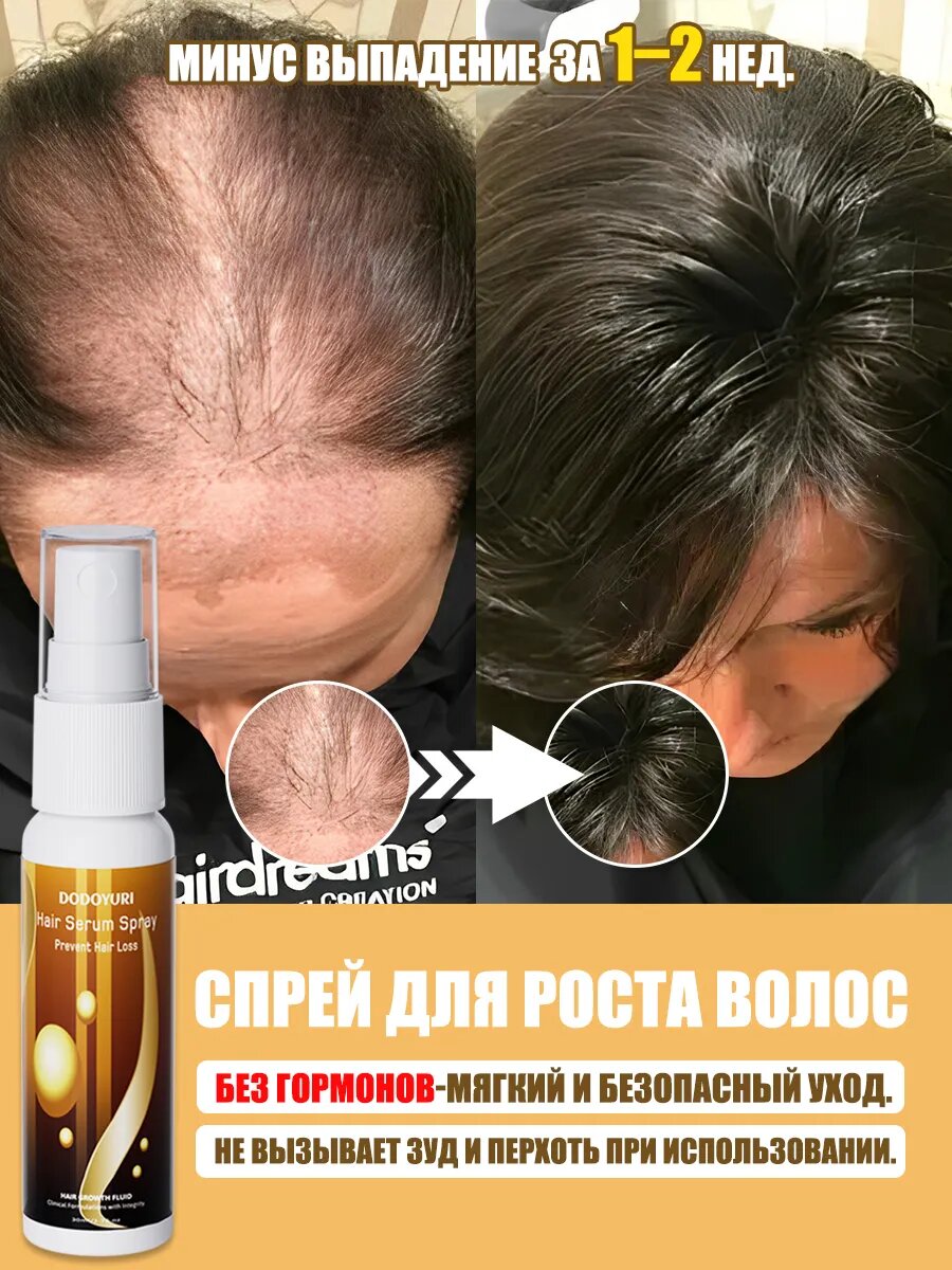 Спрей для роста волос — без гормонов, не вызывает перхоть, укрепляет волосы, подходит для женщин и мужчин