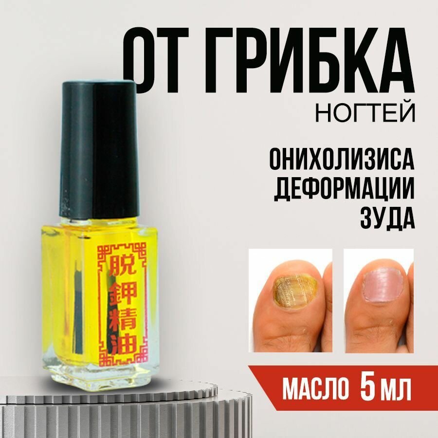 Средство от грибка ногтей на ногах и руках / масло от грибка ногтей, SilaVeres, 5 мл