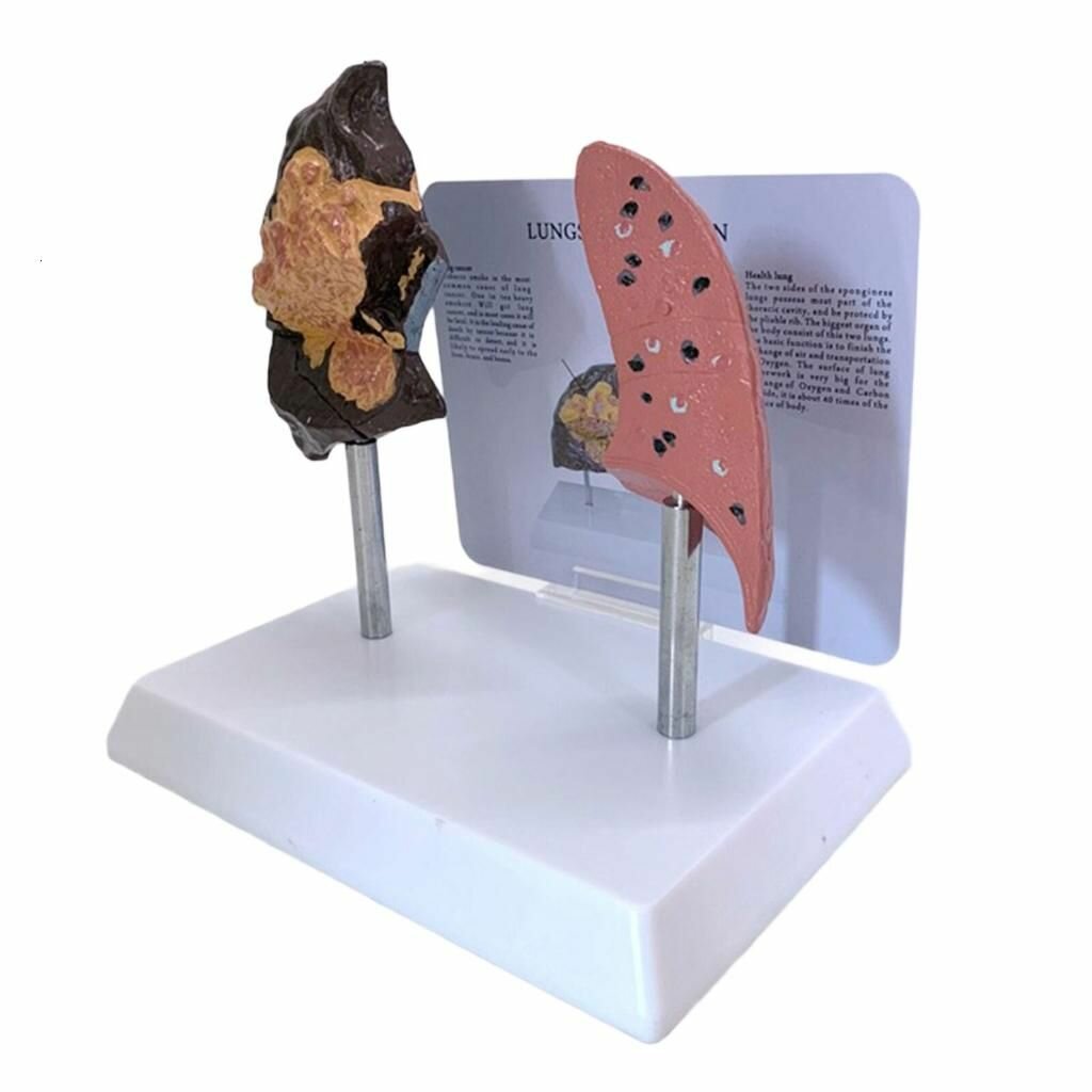 Реалистичная модель легких курильщика и здорового легкого из ПВХ для демонстрации в учебных классах