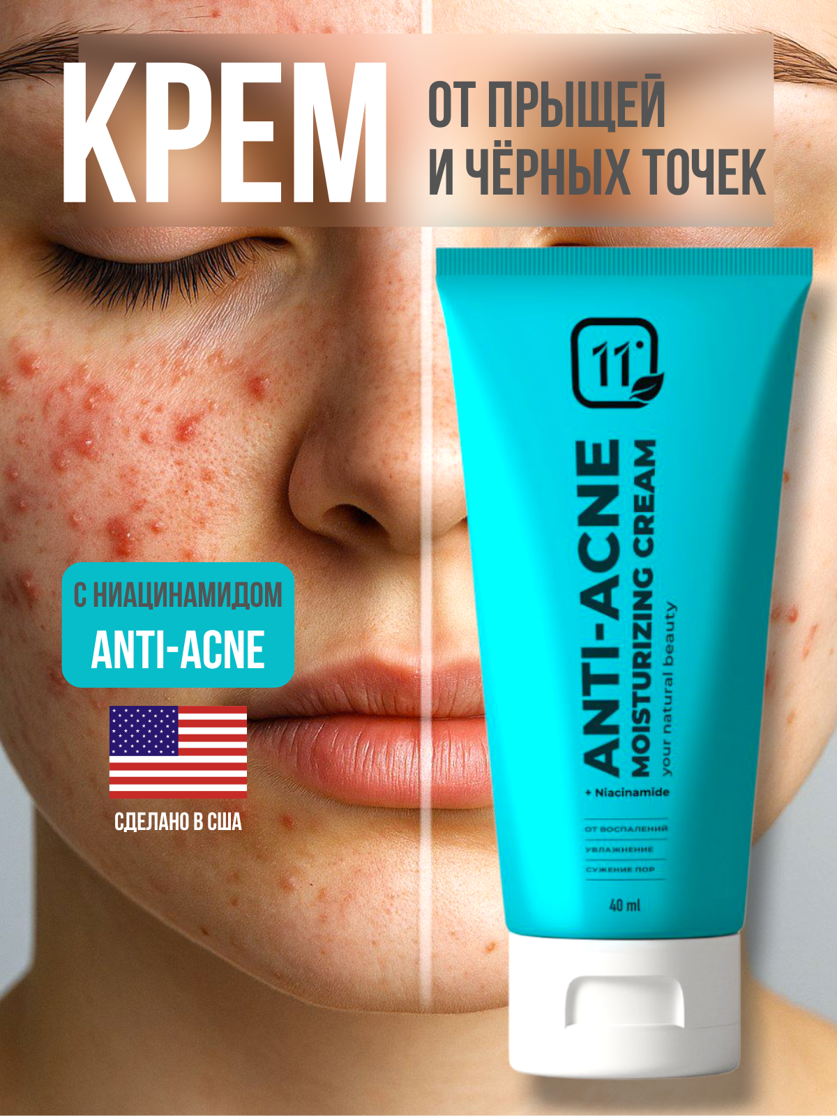 Крем от прыщей, жирного блеска и черных точек с ниацинамидом. Увлажняющий, 40 мл