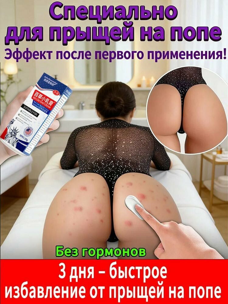 Мазь от прыщей на попе, Китайская Чудо мазь/20 мл , Устранение Прыщи на ягодицах, прыщи на волосяных фолликулах для противозудом от акне от фолликулита