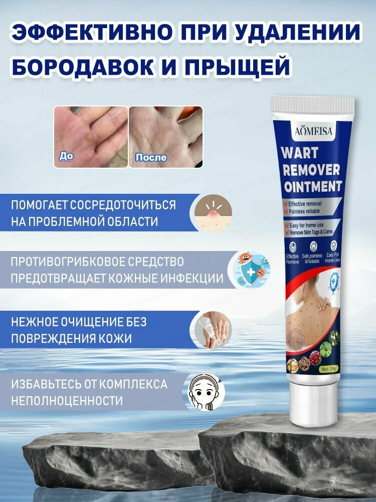 Мазь от бородавок, Крем средство для удаления бородавок, папиллом и родинок, безболезненно, не оставляет следов без побочных эффектов .20г.