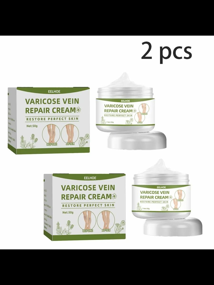 Крем для лечения варикозного расширения вен 50г Эффективное средство для снятия отечности ног, варикозного расширения вен, усталости и боли-