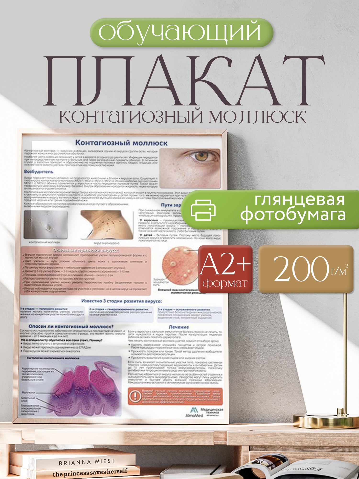 Контагиозный моллюск медицинский плакат, глянцевая фотобумага от 200 г/кв. м, размер A2+