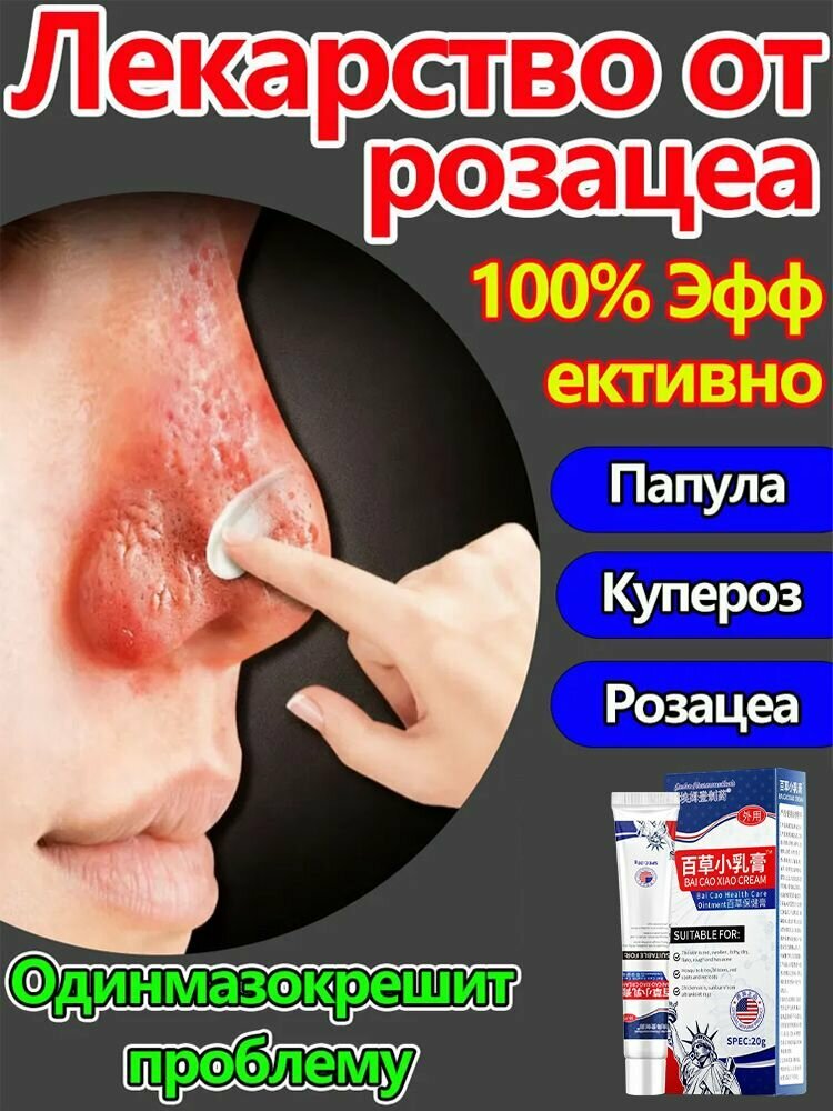 Крем для лечения розацеа и купероза, снимает покраснение и раздражение кожи, уменьшает проявление сосудов, 20 г.