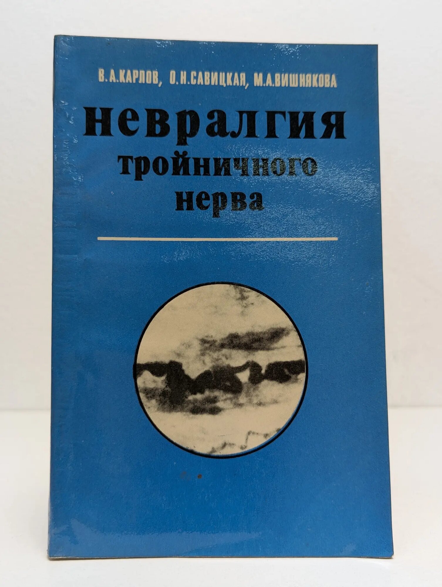 Невралгия тройничного нерва Карлов Владимир Алексеевич, Савицкая Ольга Николаевна, Вишнякова М. А. 1980