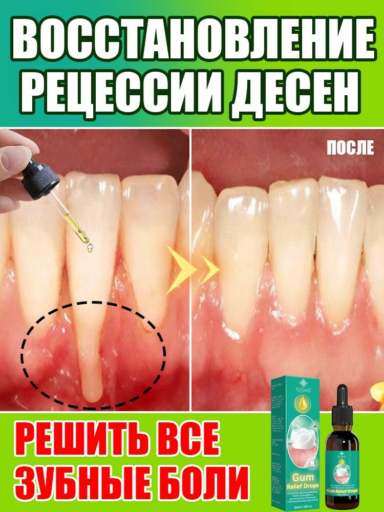 Масло для гигиены полости рта/для чувствительных десен/ пародонтоза, Быстро лечит опухшие и отступающие десны, пародонтит, снимает чувствительность десен и поддерживает гигиену полости рта,150 мл