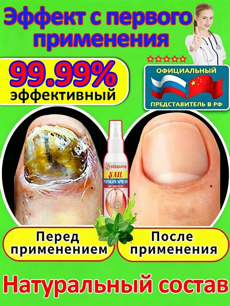 Спрей от грибка ногтей,30 мл, для лечения плесневых инфекций, укрепления ногтей, удаления рогового слоя и устранения онихомикоза.