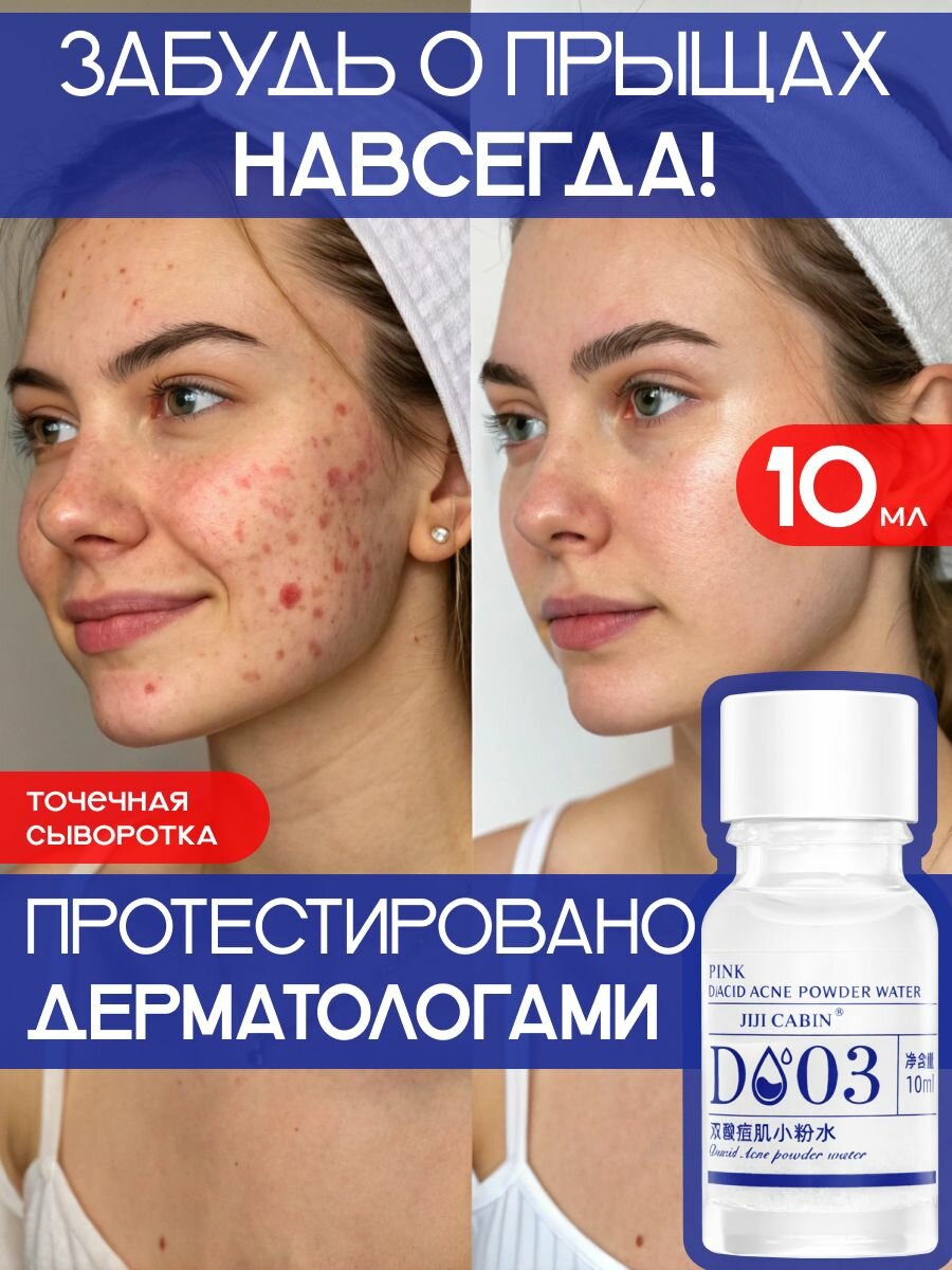 Средство от прыщей на лице, крем / сыворотка от прыщей, для сужения пор, "Plant", 10 мл