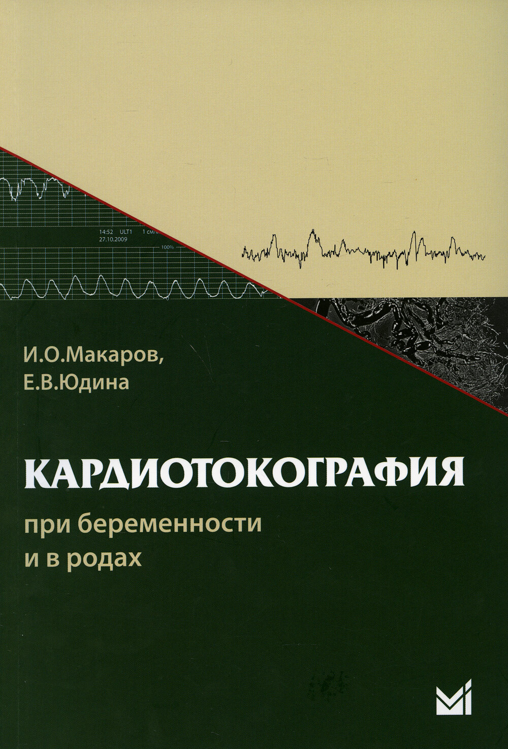 Кардиотокография при беременности и в родах. 8-е изд. Макаров И. О, Юдина Е. В.