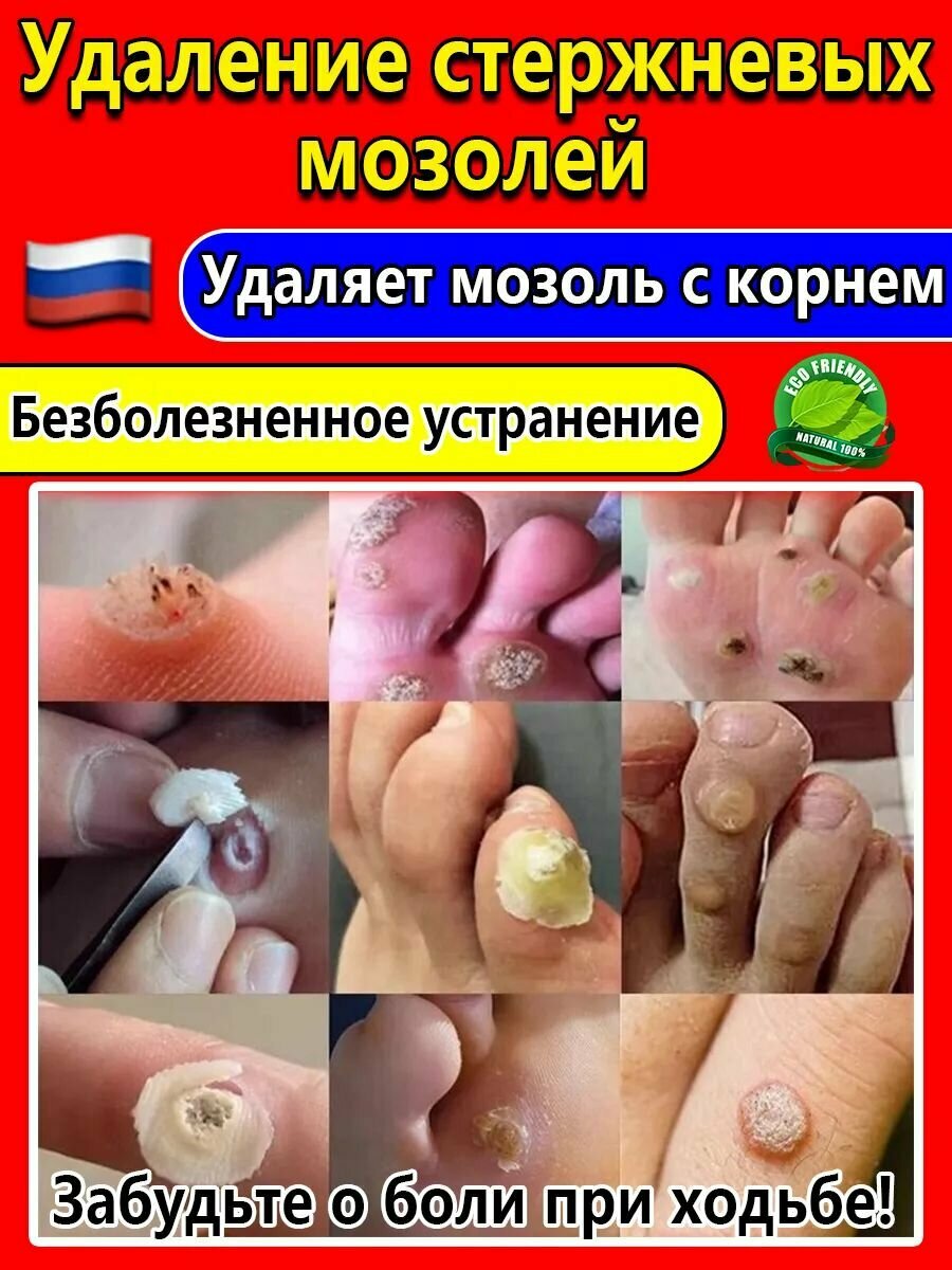 Средство для удаления огрубевшей кожи, трещин на пятках, сухих мозолей, натоптышей и мочевины, 20 г