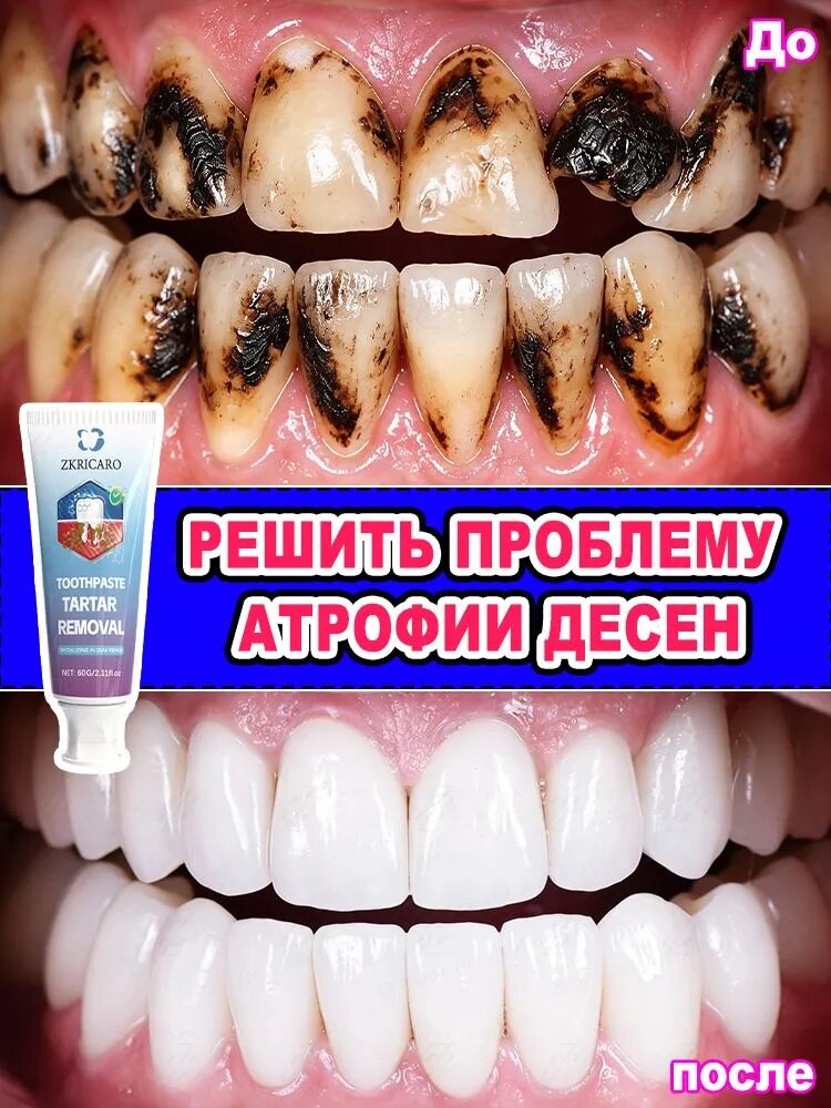 Эта зубная паста удаляет зубной налет, предотвращает кариес, восстанавливает зубную эмаль