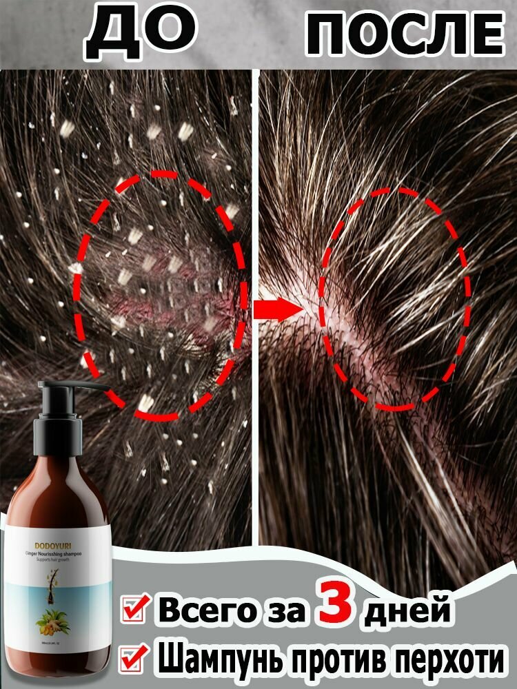 Шампунь против перхоти , от себореи, 300 мл, для всех типов волос