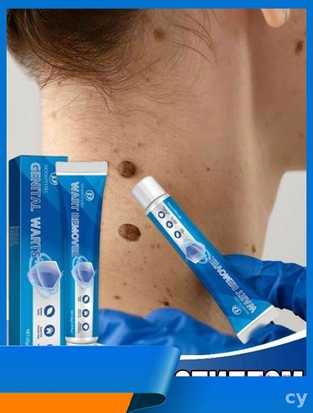 LUKAOHUA / Мазь от бородавок, Крем средство для удаления бородавок, папиллом и родинок, безболезненно, не оставляет следов без побочных эффектов / 20г