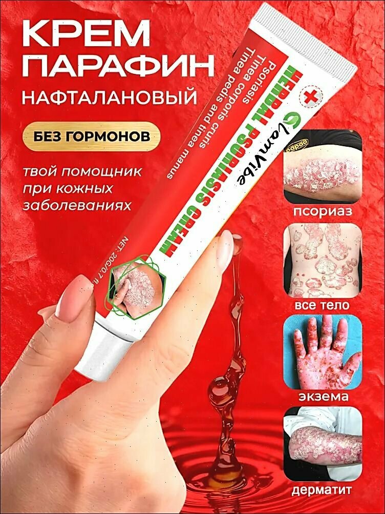 Мазь для лечения псориаза, экземы, дерматита, лишая, угревой сыпи, прыщей, способна быстро снять раздражение и покраснение кожи,20г