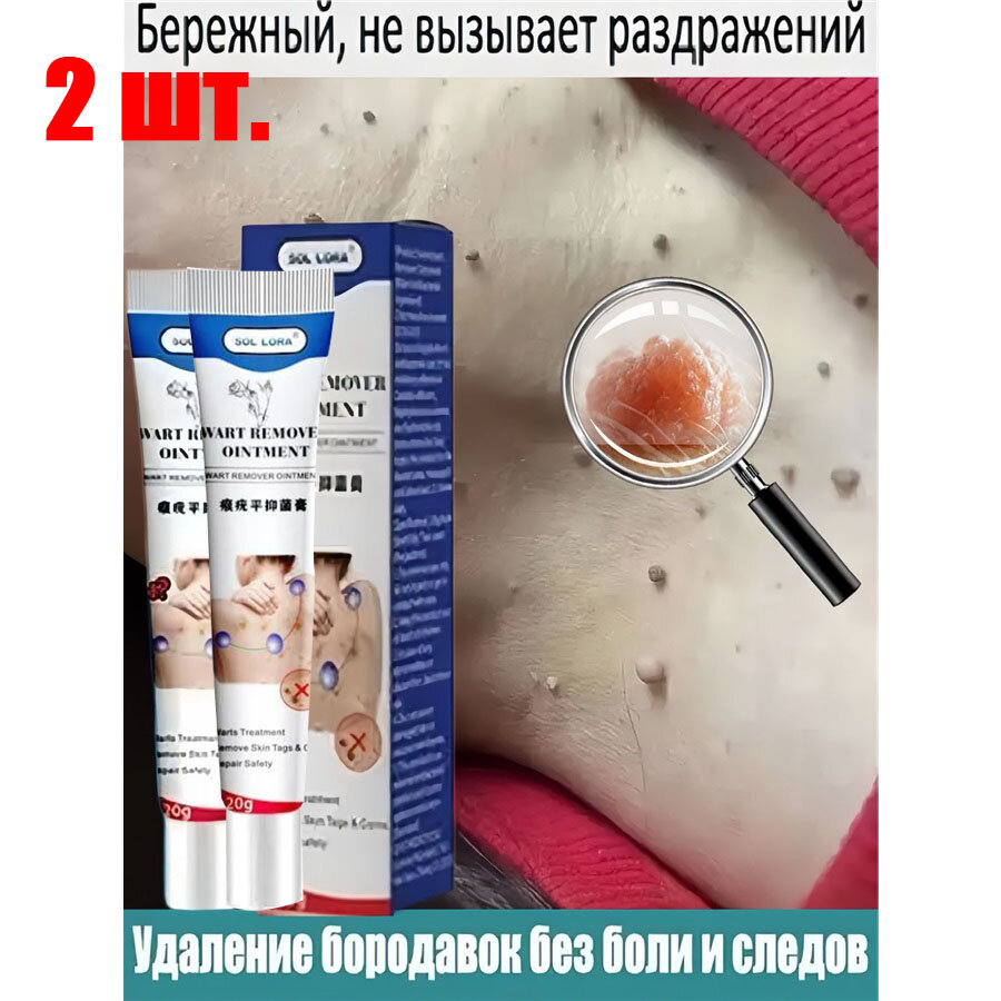 2*20г Крем для удаления бородавок и родинок, чистотел от бородавок, папиллом, кондилом, натоптышей, Натуральные растительные ингредиенты, безопасные и эффективные