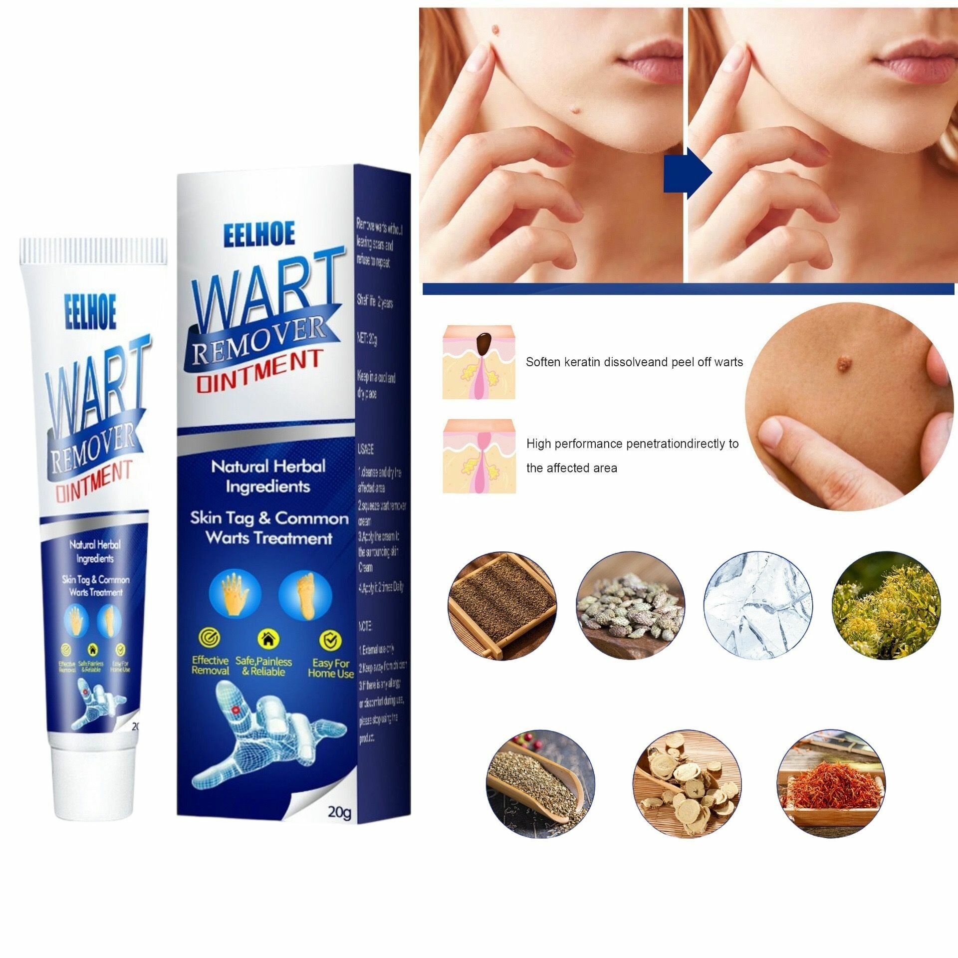 Китайская мазь от бородавок и папиллом на теле