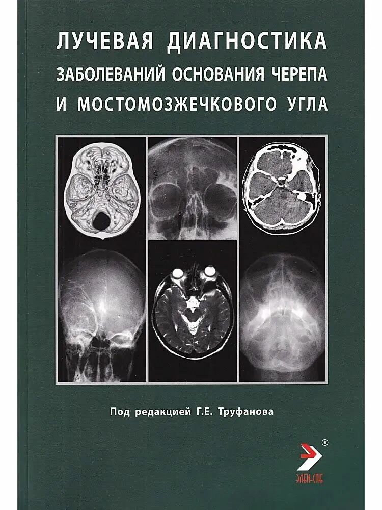 Лучевая диагностика заболеваний основания черепа и мостомозжечкового угла