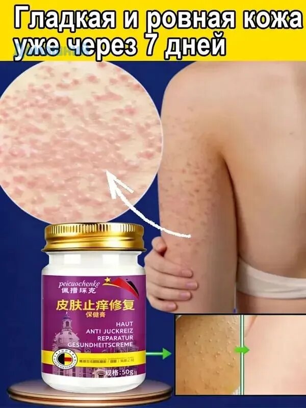 Крем для тела от гусиной кожи и сухости 50ml