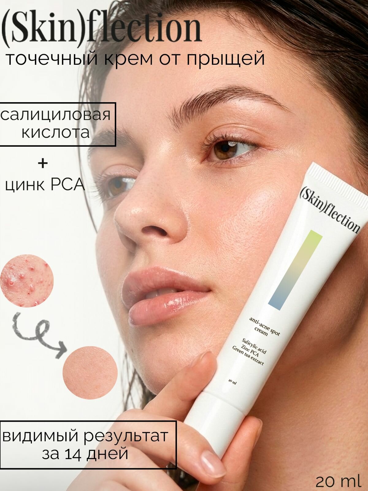 Точечный крем от прыщей. Корректор точечный против прыщей, крем от акне Skin Flection