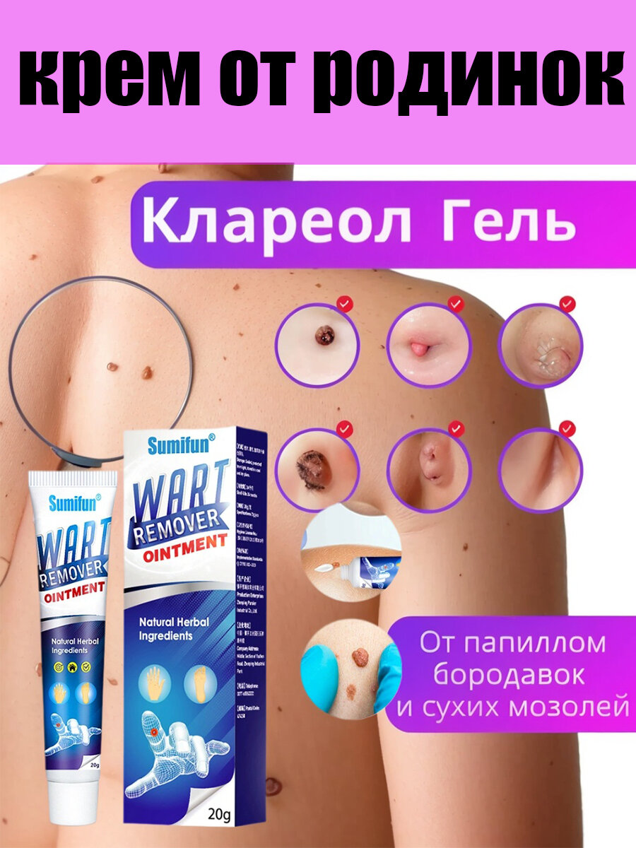 Китайская мазь от бородавок и папиллом на теле