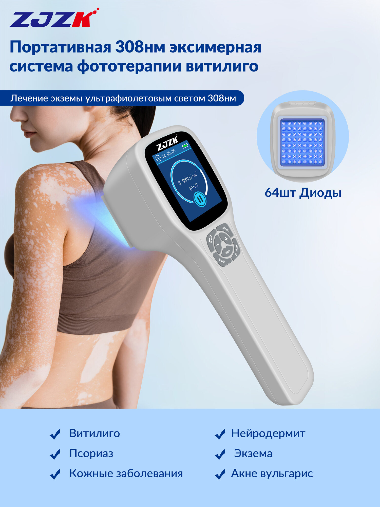 Лазер 308 нм для лечения витилиго и псориаза – Точечная УФB фототерапия для восстановления кожи