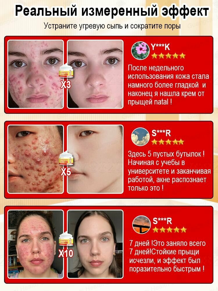 Крем от прыщей точечный, от акне комедонов угрей черных точек, средство для подростков, для проблемной кожи, гель от прыщей на лице cалициловая