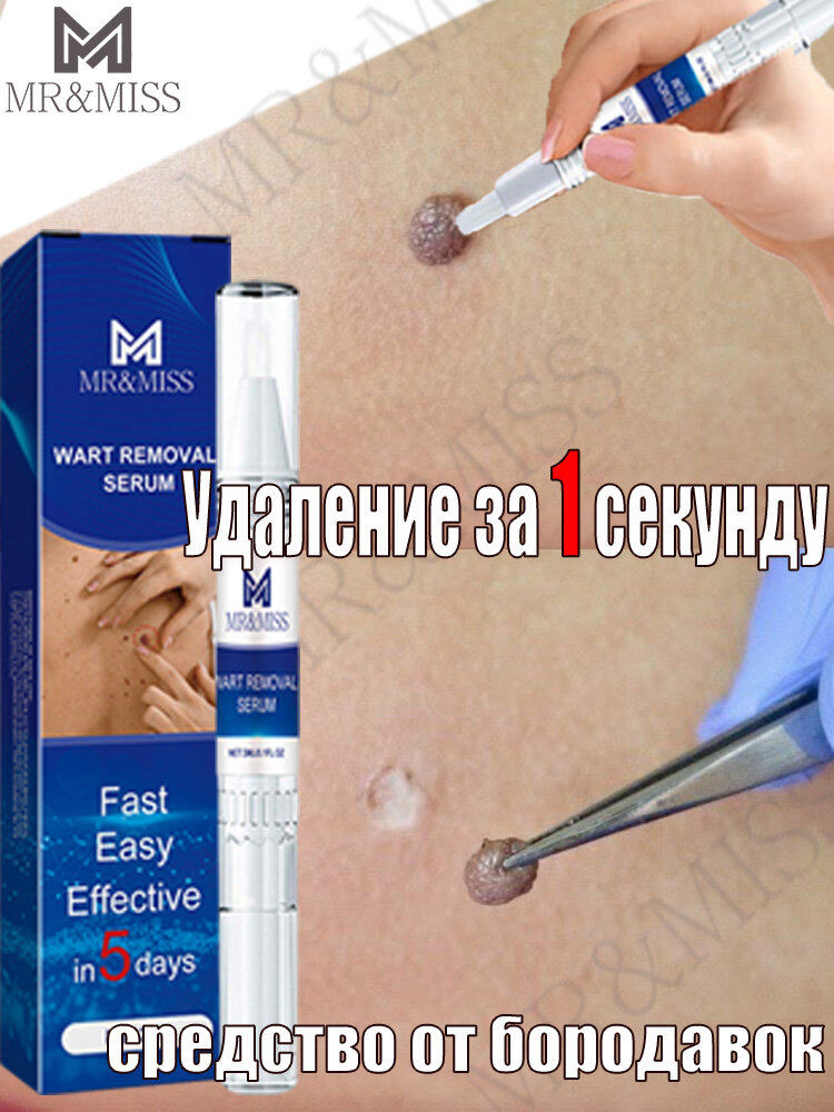 MR&MISS /Эссенция для удаления бородавок, папиллом и родинок, безболезненно, без шрамов и побочных эффектов.