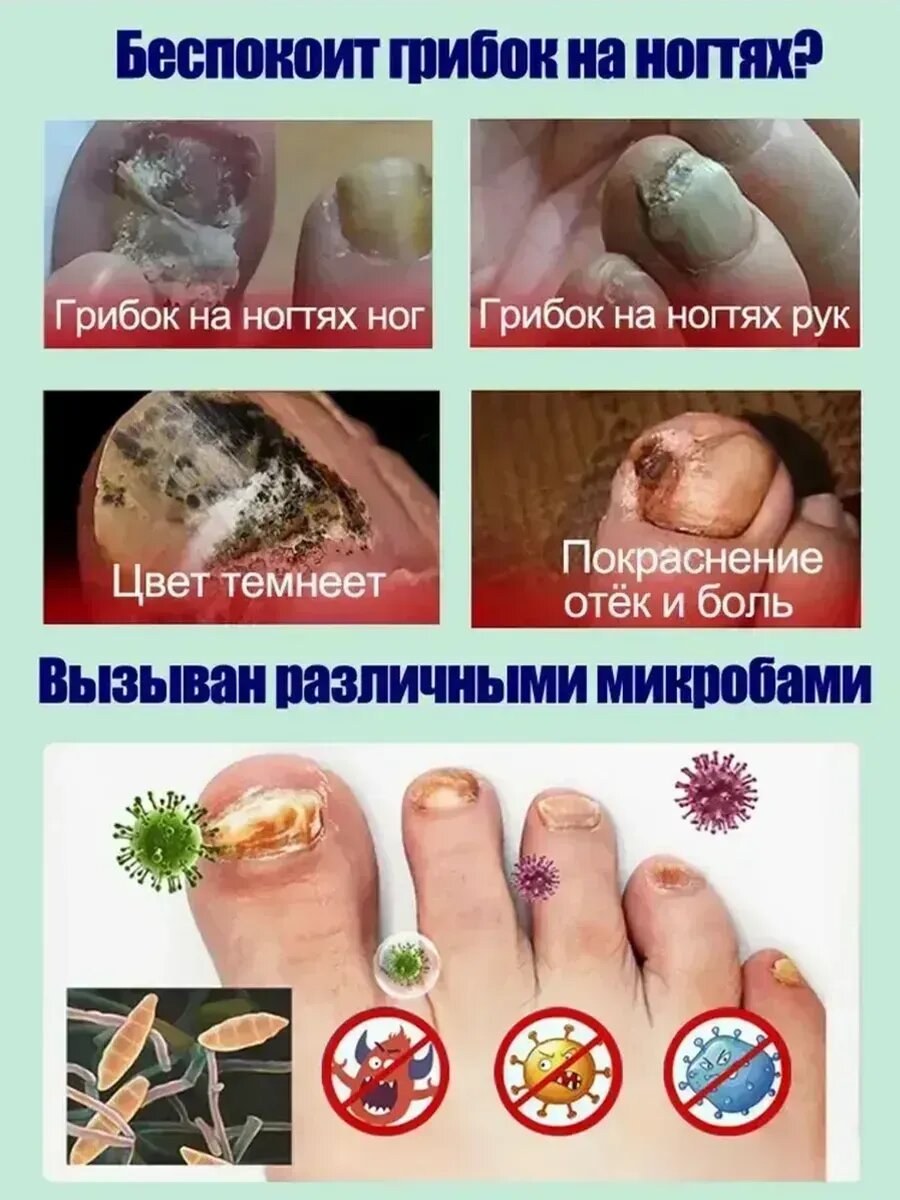 Фунгодерил противогрибковое средство для ногтей раствор — фото 1