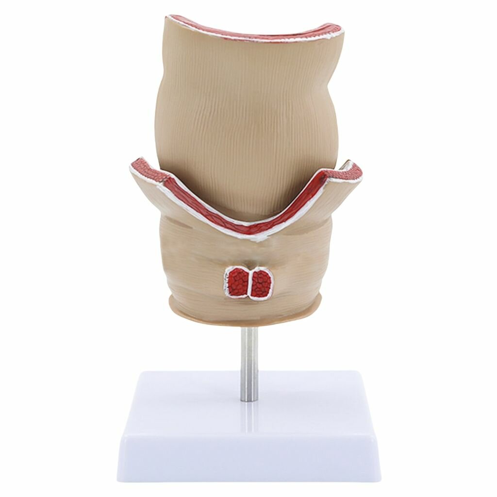 Модель патологии прямой кишки